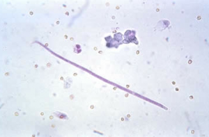 What The Muck Is That? Neck Threadworms | HORSE NATION