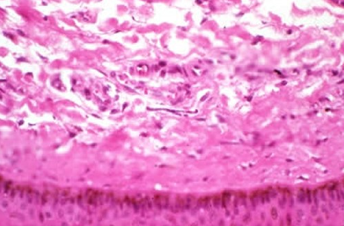 What The Muck Is That? Neck Threadworms | HORSE NATION