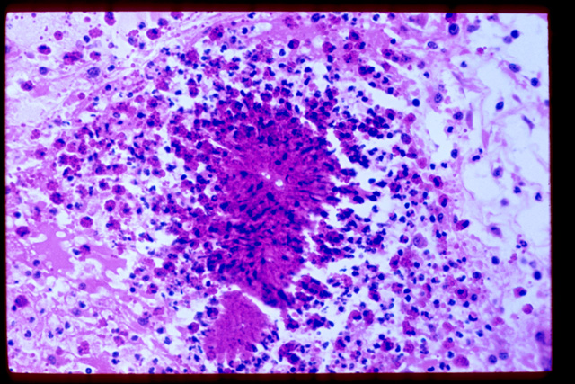 What The Muck Is That? ‘Swamp Cancer’ | HORSE NATION